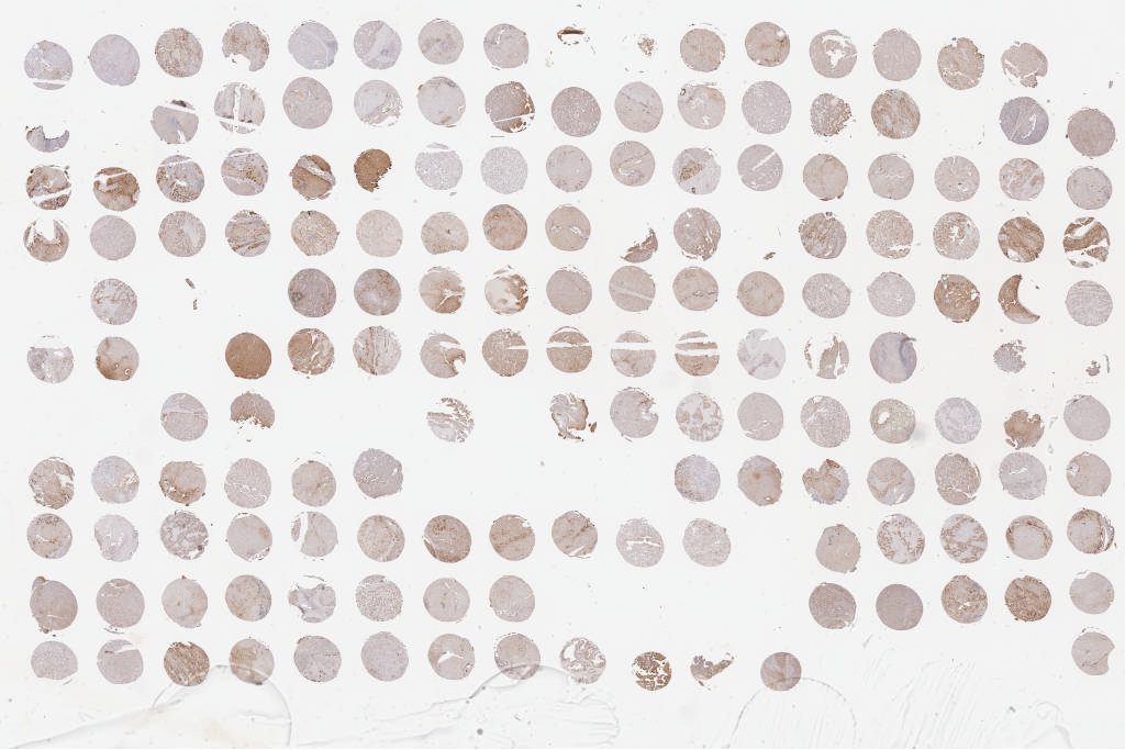 Digital Slide Viewer: TMA Slides