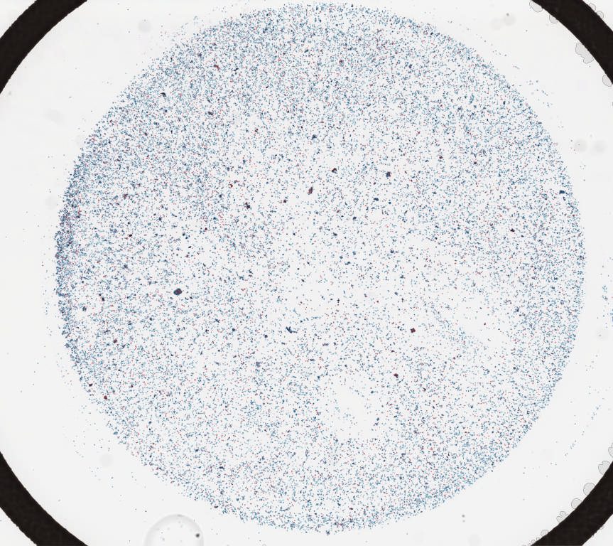 Digital Slide Viewer: ThinPrep