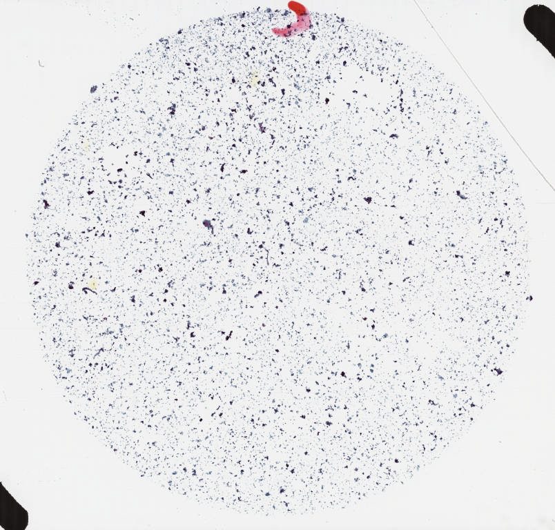 Digital Slide Viewer: Thinprep PAP test Teaching cases