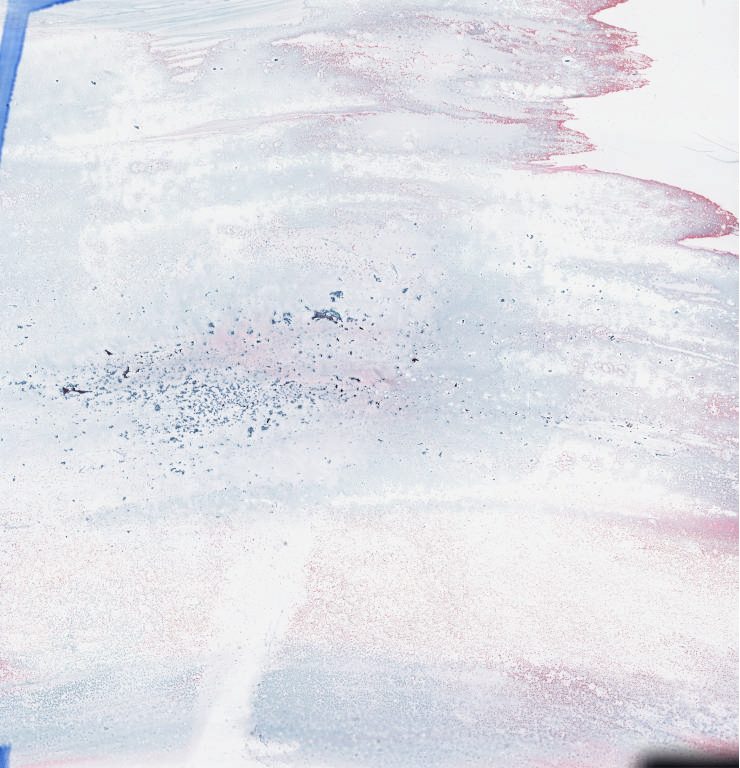 Digital Slide Viewer: lectures\fellows\lung-subtyping-virtual-online ...