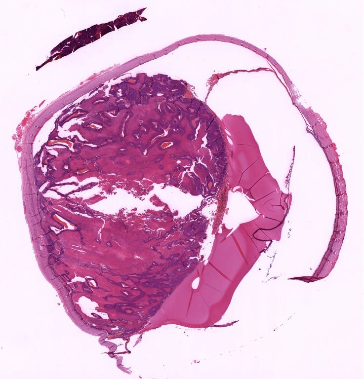 Digital Slide Viewer: neuropathology\Eye