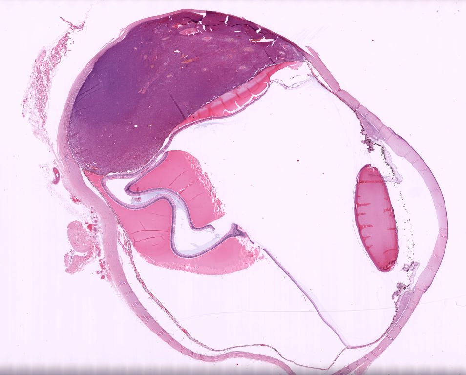 Digital Slide Viewer: neuropathology\Eye