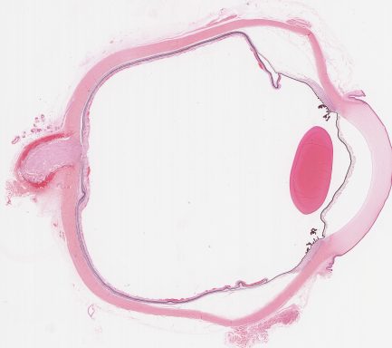 Digital Slide Viewer: neuropathology\Eye