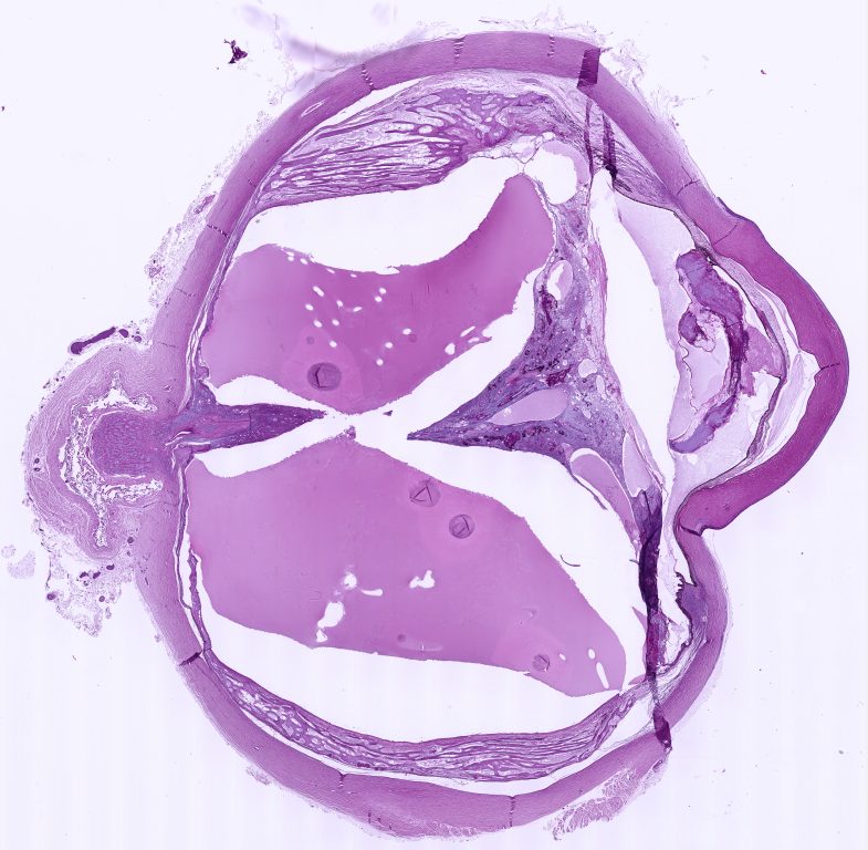 Digital Slide Viewer: neuropathology\Eye