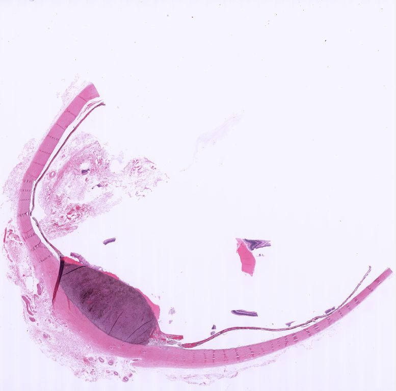 Digital Slide Viewer: neuropathology\Eye