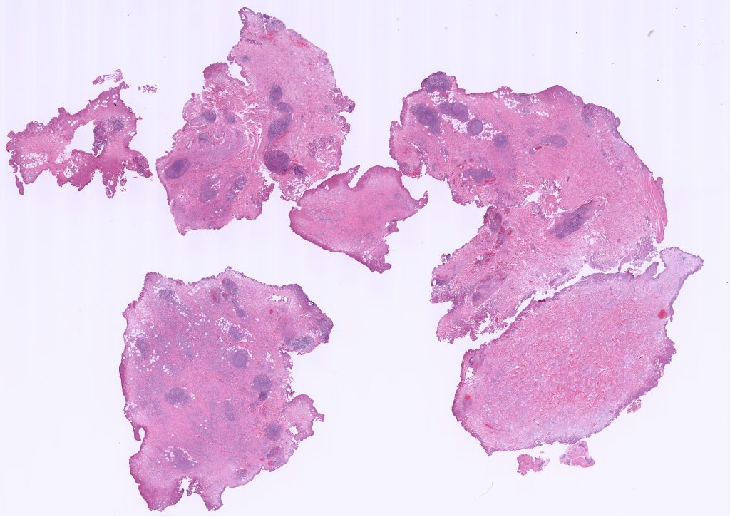 Digital Slide Viewer: neuropathology\Eye