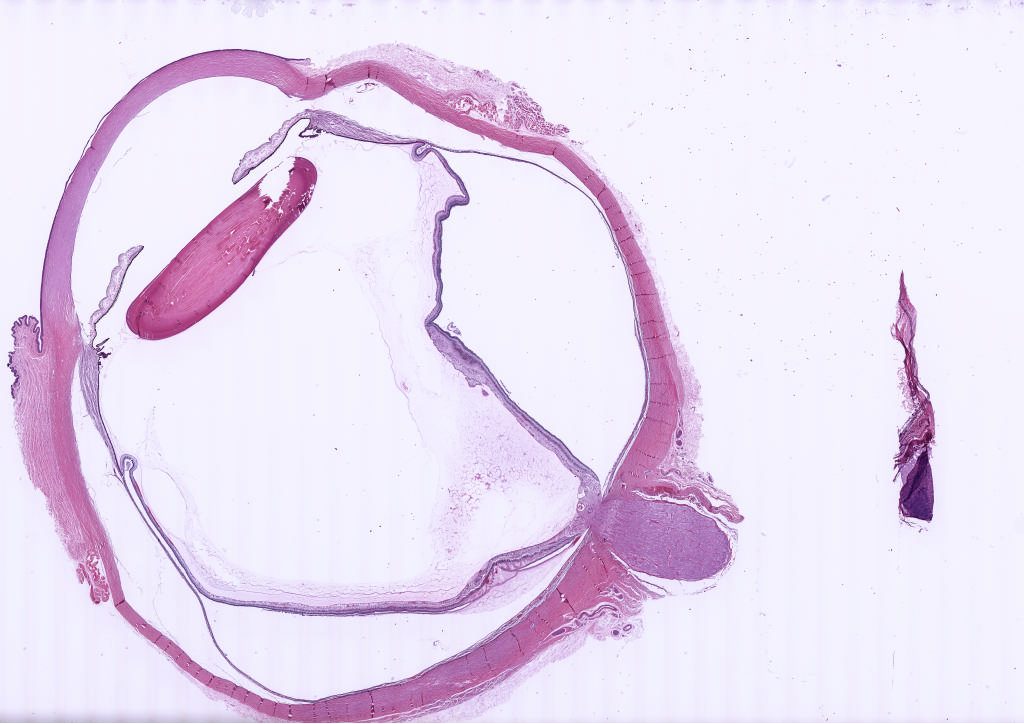 Digital Slide Viewer: neuropathology\Eye