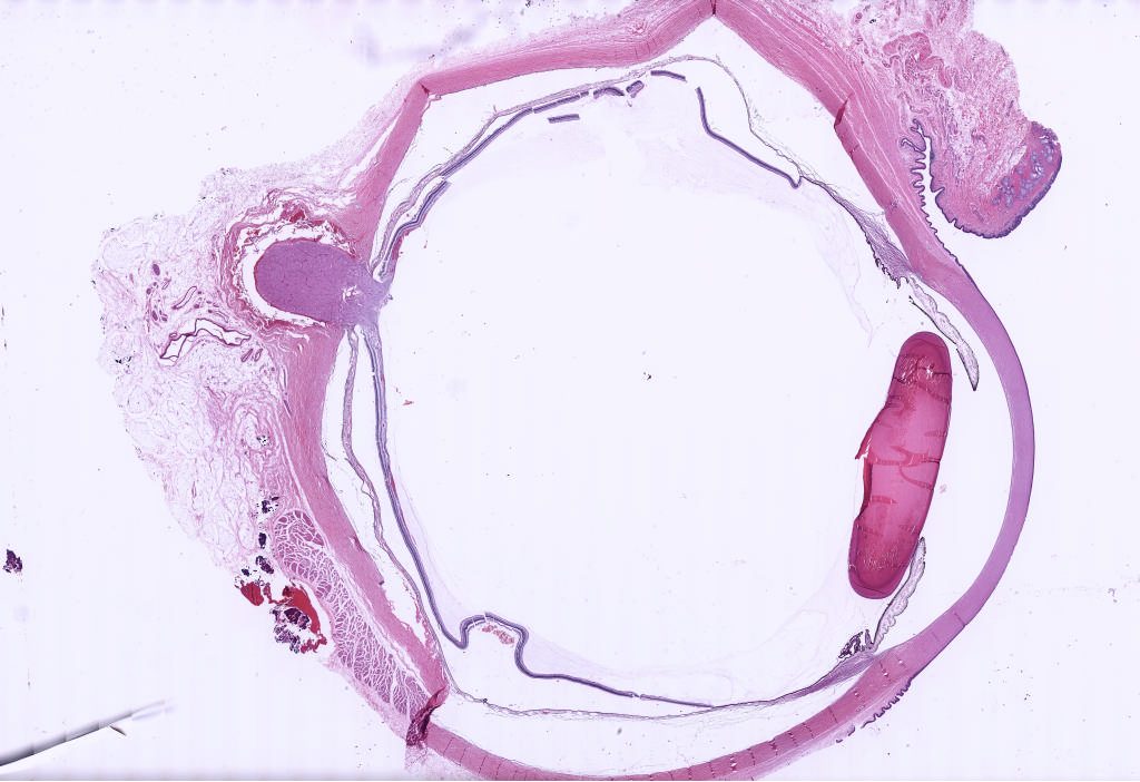 Digital Slide Viewer: neuropathology\Eye