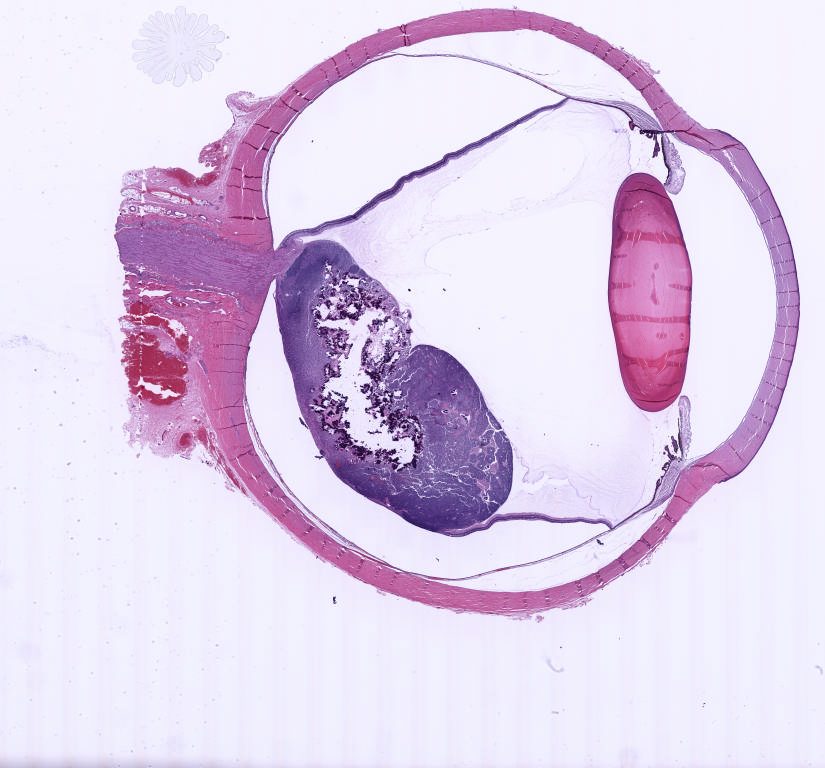 Digital Slide Viewer: neuropathology\Eye
