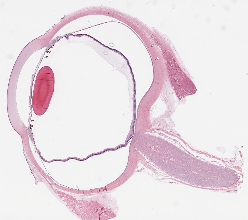 Digital Slide Viewer: neuropathology\Eye