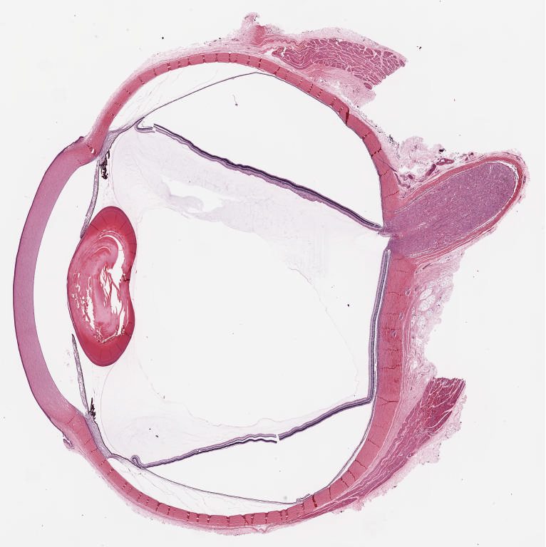 Digital Slide Viewer: neuropathology\Eye