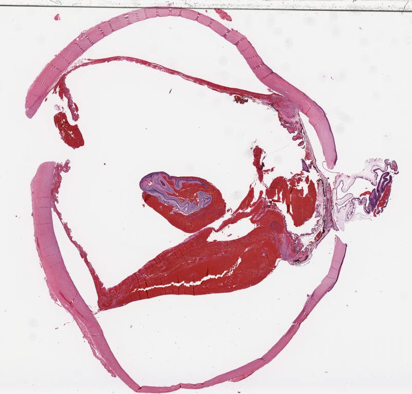 Digital Slide Viewer: neuropathology\Eye