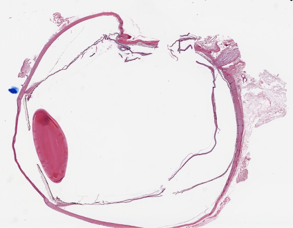 Digital Slide Viewer: neuropathology\Eye