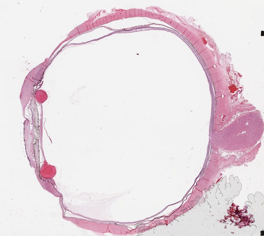 Digital Slide Viewer: neuropathology\Eye