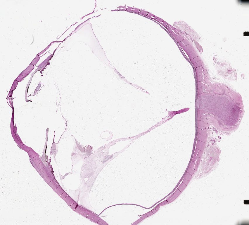 Digital Slide Viewer: neuropathology\Eye
