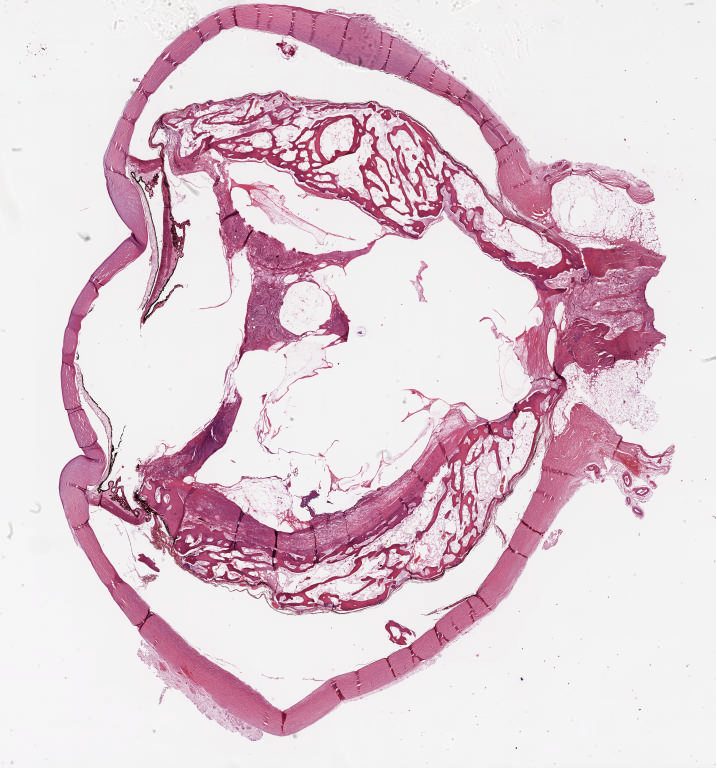 Digital Slide Viewer: neuropathology\Eye