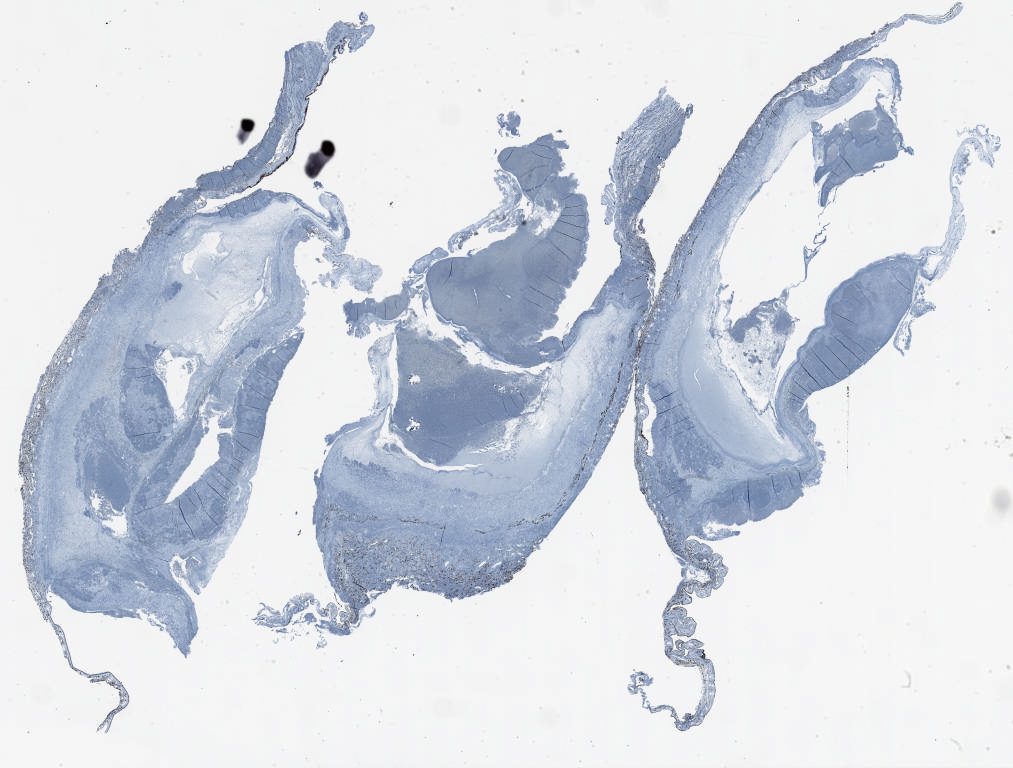 Digital Slide Viewer: neuropathology\Eye