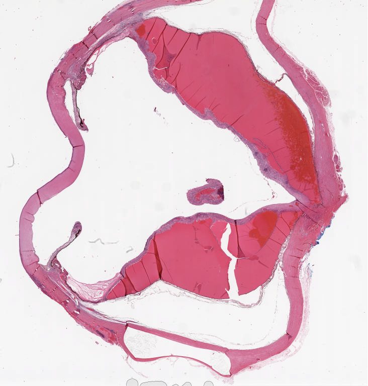 Digital Slide Viewer: neuropathology\Eye