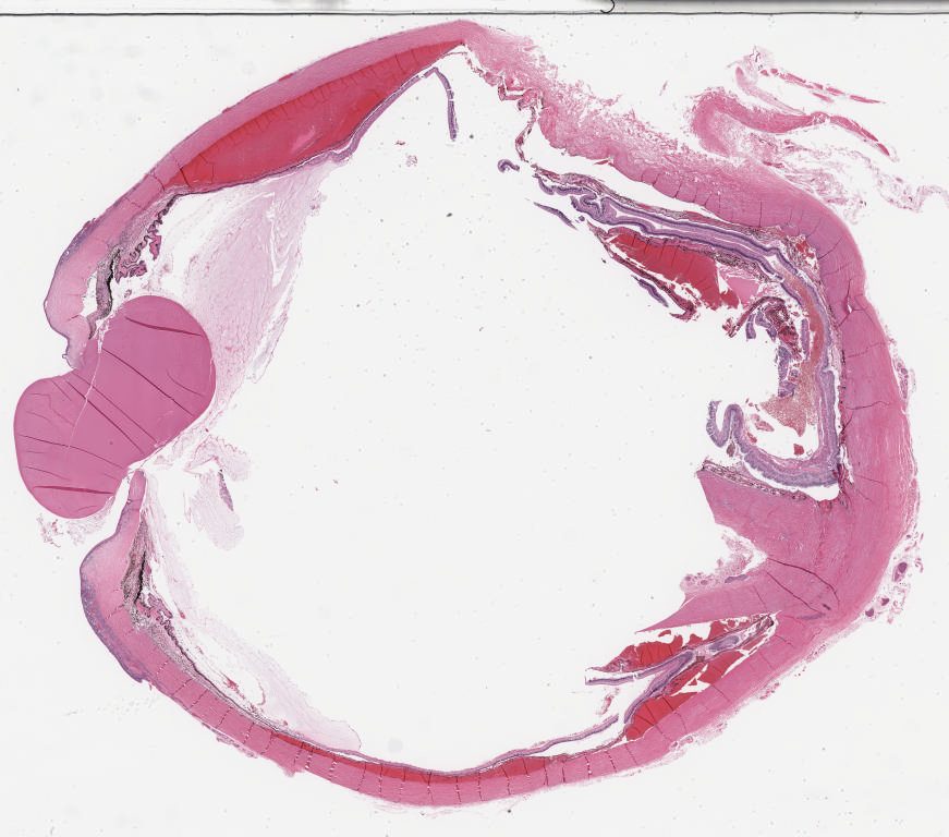 Digital Slide Viewer: neuropathology\Eye\Eye13