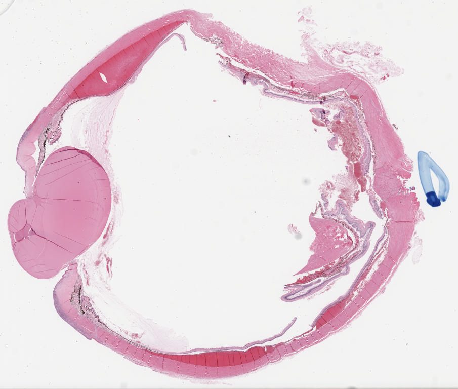 Digital Slide Viewer: neuropathology\Eye\Eye13