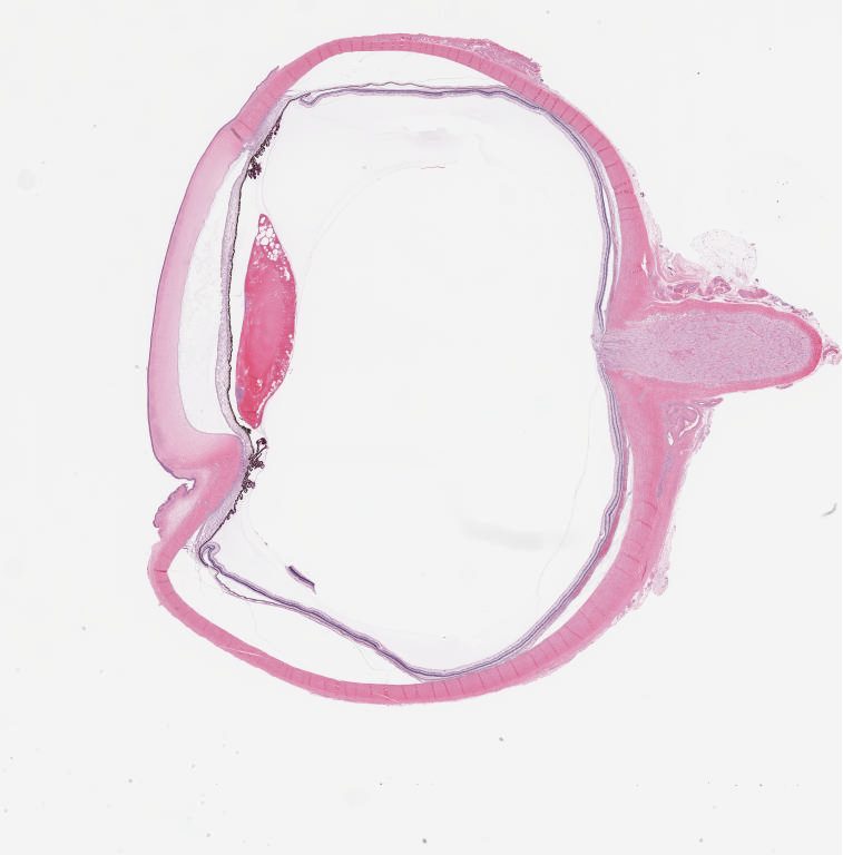 Digital Slide Viewer: neuropathology\Eye\Eye4