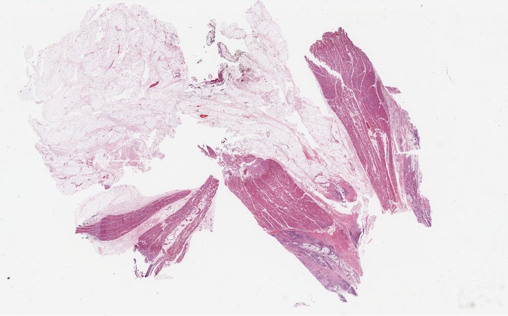 Digital Slide Viewer: neuropathology\Eye\Eye5
