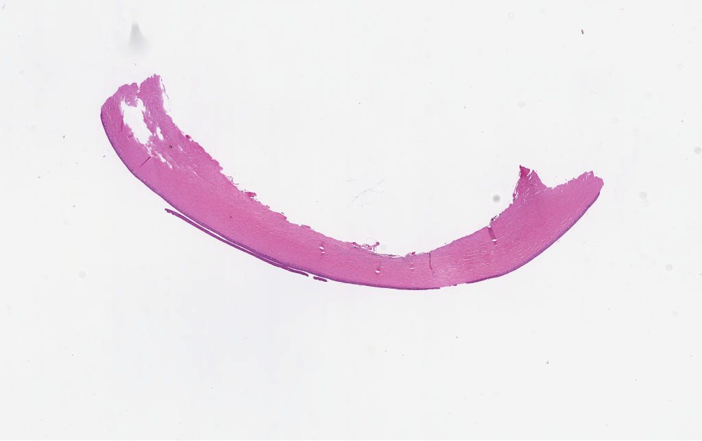 Digital Slide Viewer: neuropathology\Eye\Eye5