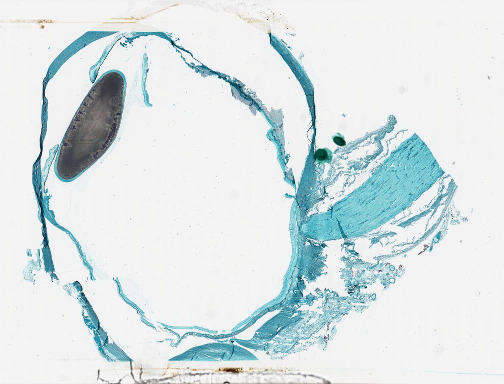Digital Slide Viewer: neuropathology\Eye\Eye8