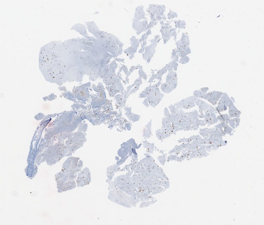 Digital Slide Viewer: neuropathology\Neurodegenerative