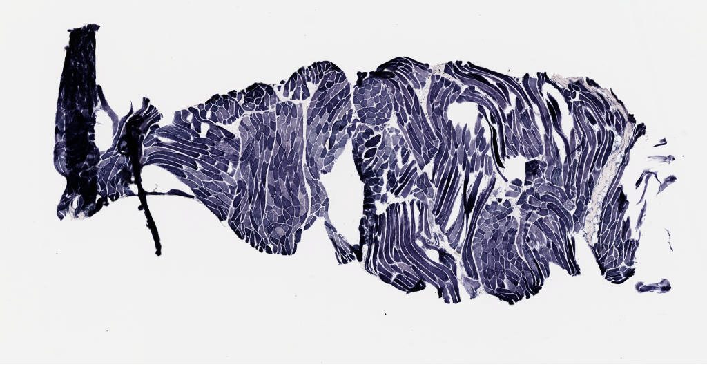 Digital Slide Viewer: neuropathology\NeuromuscularQuiz\M.36MuscleBX
