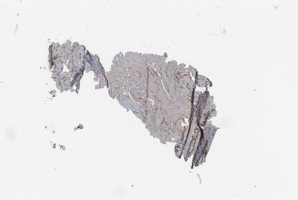 Digital Slide Viewer: neuropathology\NeuromuscularQuiz\NeuroMuscular5