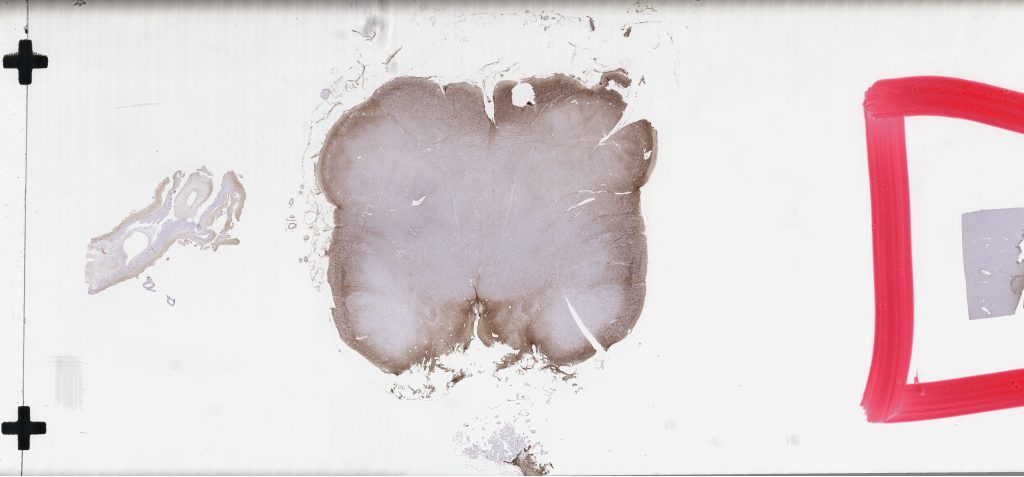 Digital Slide Viewer: neuropathology\Vascular