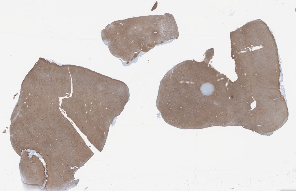 Digital Slide Viewer: neuropathology\vascular\Vascular2