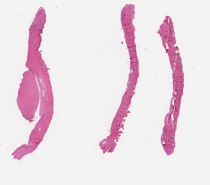 Digital Slide Viewer: neuropathology\vascular\Vascular5