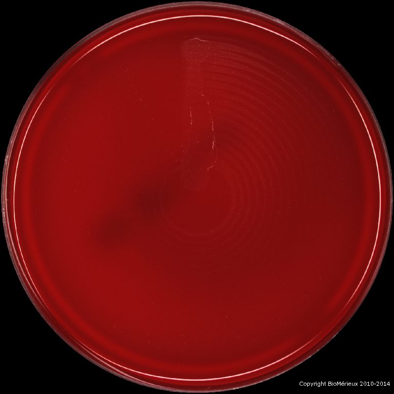 Digital Slide Viewer: postersqrbarcodes\pantanowitz\Digital_Plate ...