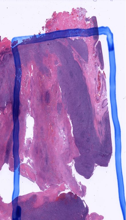 Digital Slide Viewer: swerdlow\New