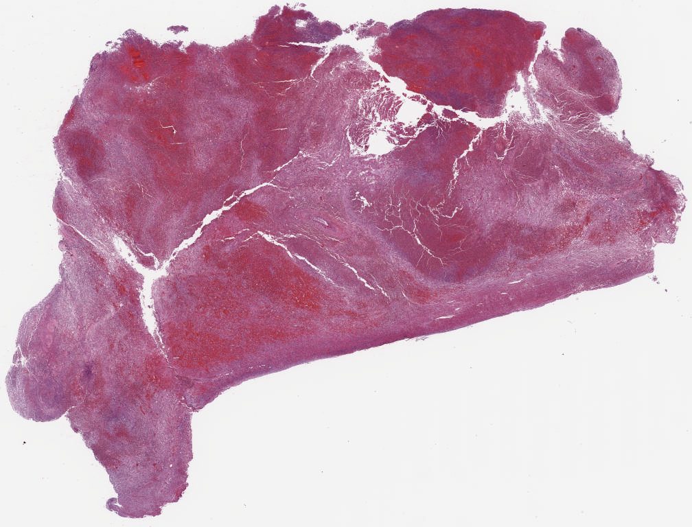 Digital Slide Viewer: upmc-pathology-center-of-excellence\Autopsy