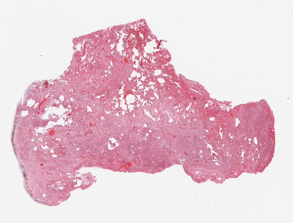 Digital Slide Viewer: upmc-pathology-center-of-excellence\Autopsy