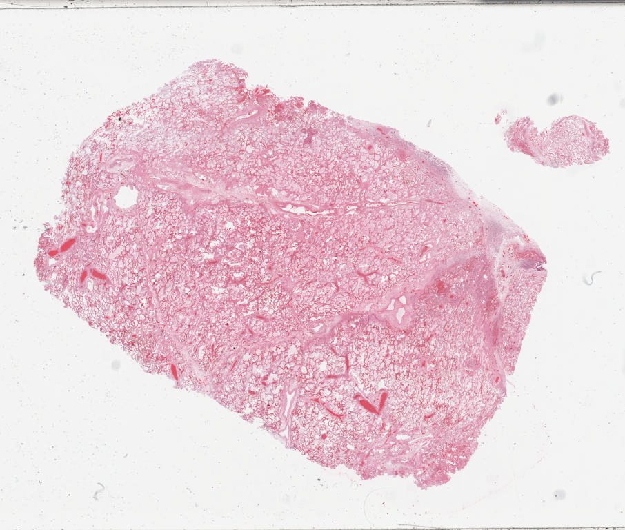 Digital Slide Viewer: upmc-pathology-center-of-excellence\Autopsy