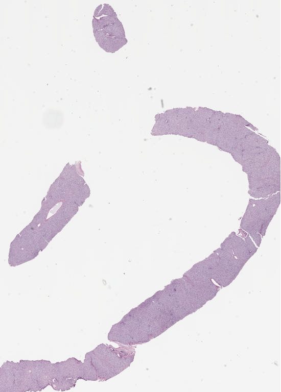 Digital Slide Viewer: upmc-pathology-center-of-excellence\GI