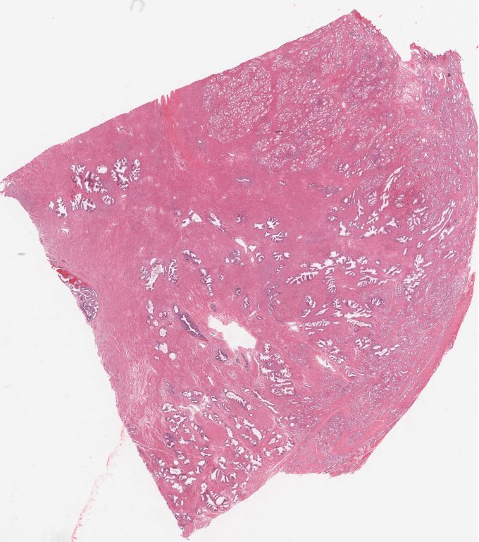 Digital Slide Viewer: upmc-pathology-center-of-excellence\gu-coe\gu ...