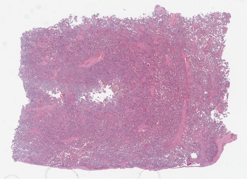 Digital Slide Viewer: upmc-pathology-center-of-excellence\placenta\Set1