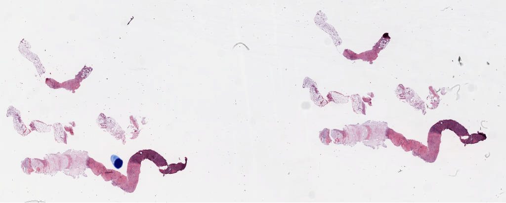 Digital Slide Viewer: upmc-pathology-center-of-excellence\transplant ...